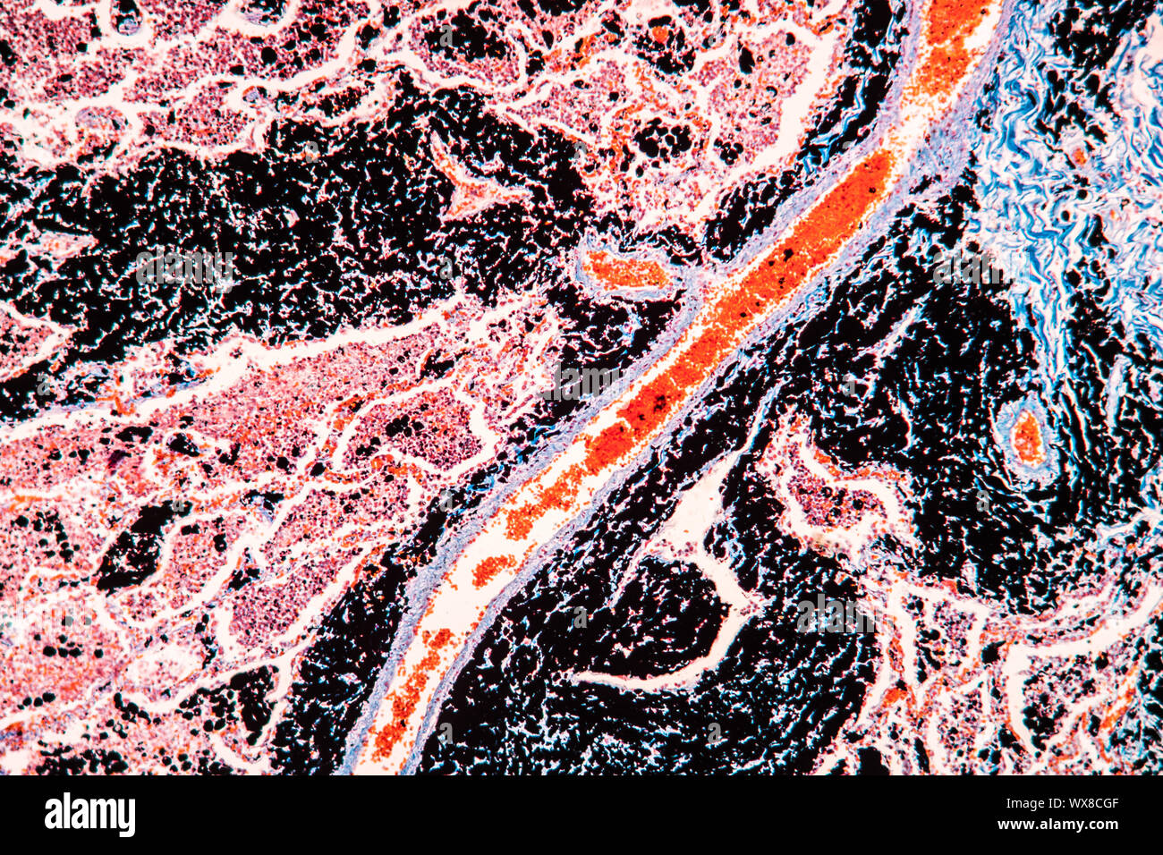 Dust under the microscope hi-res stock photography and images - Alamy