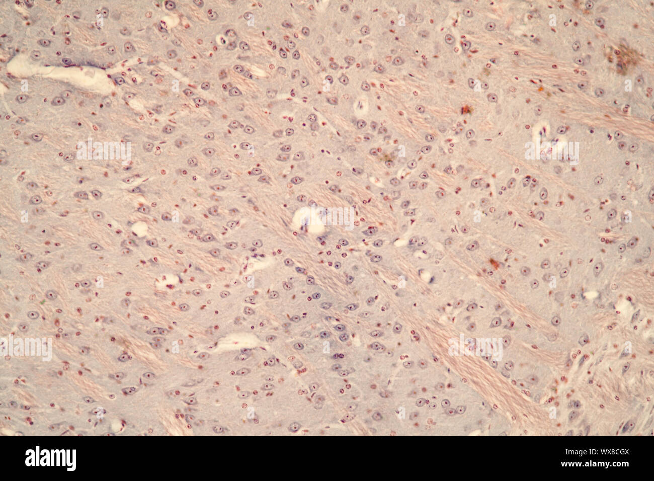 Mouse brain tissue under the microscope 100x Stock Photo - Alamy