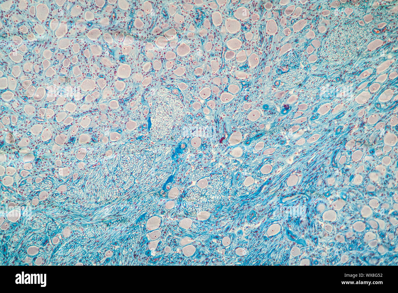 soft palate tissue under the microscope 100x Stock Photo - Alamy
