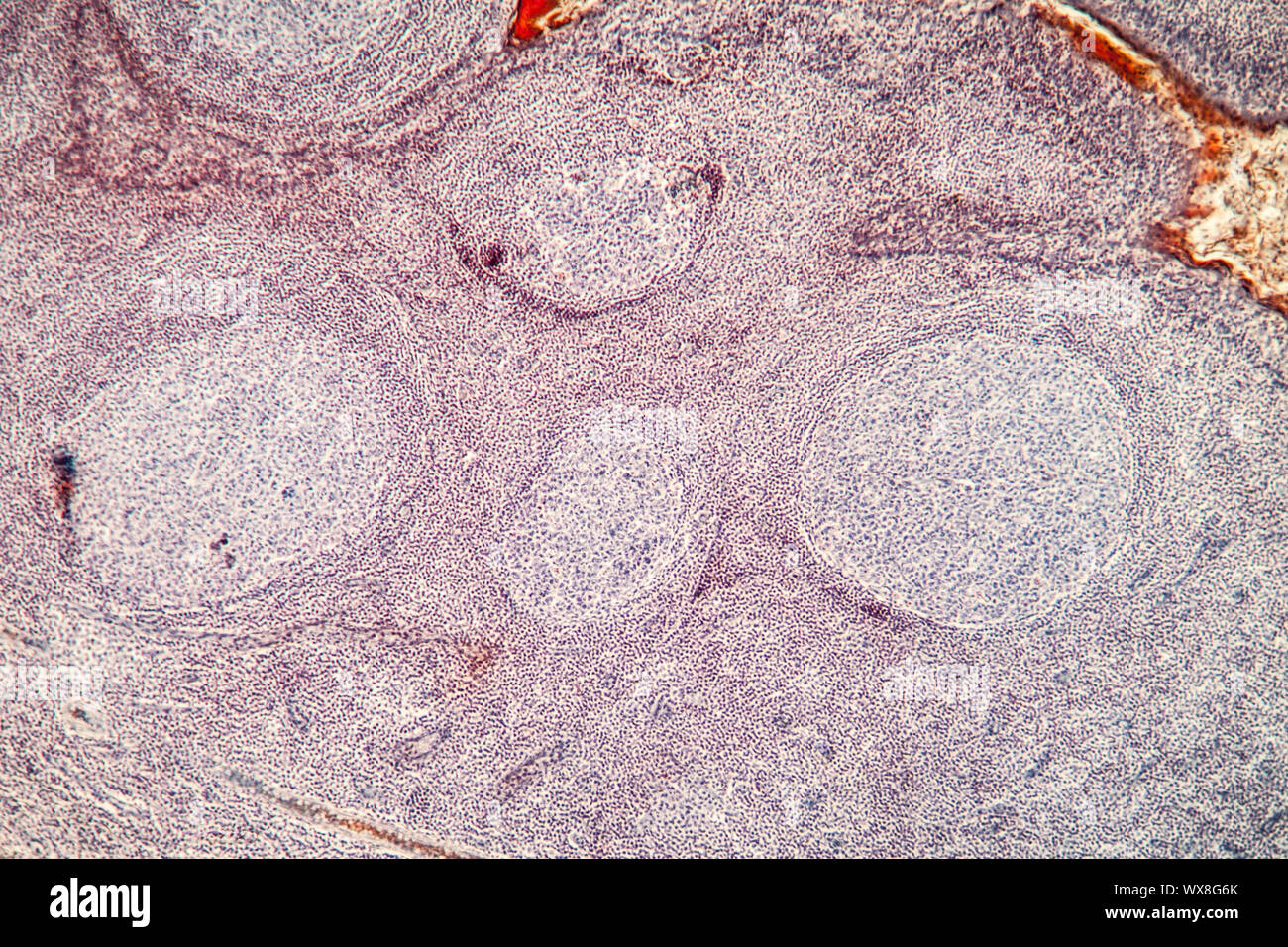 Pharyngeal Tonsils Histology Labeled
