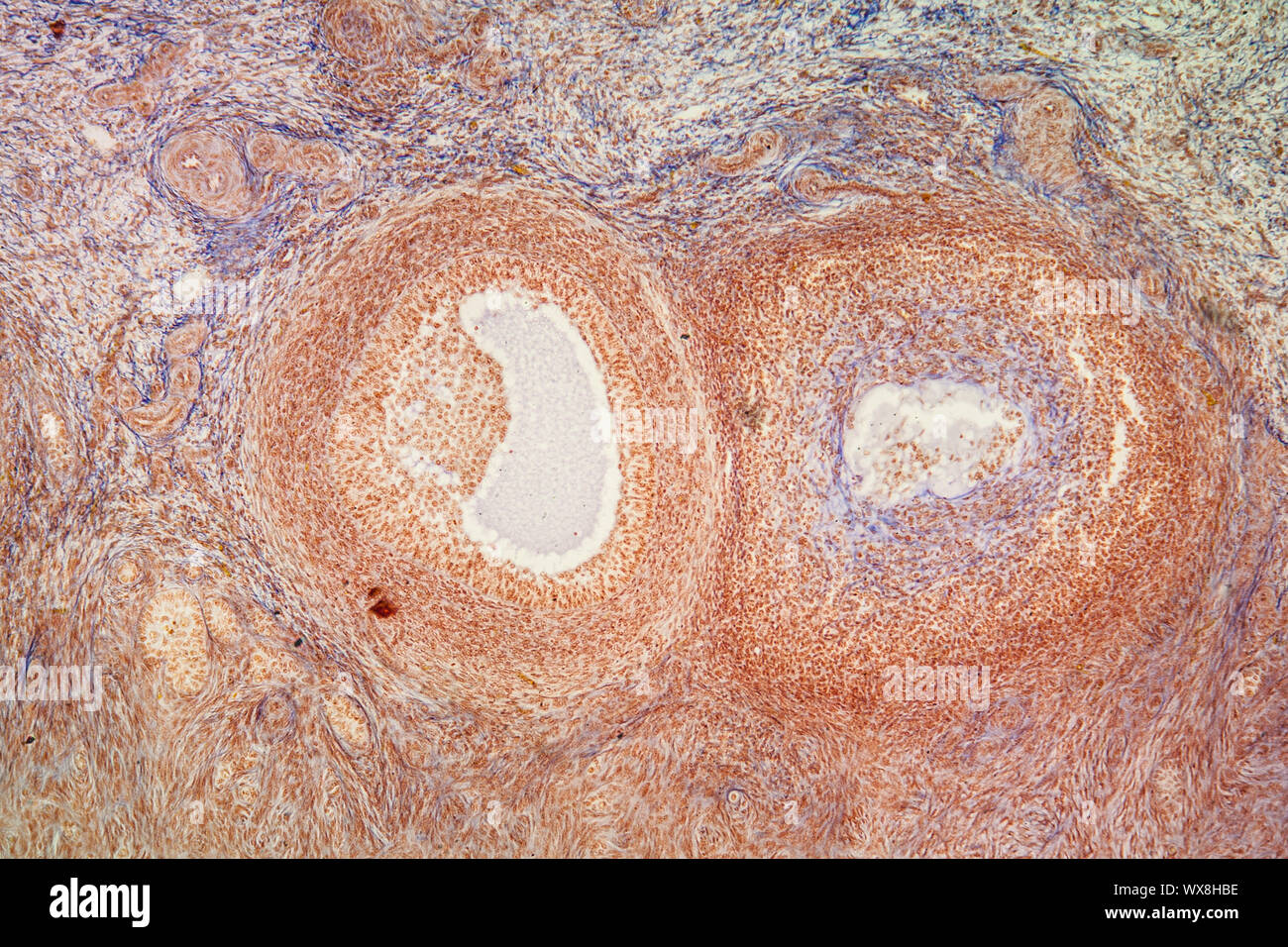 Ovary tissue under microscope hi-res stock photography and images - Alamy