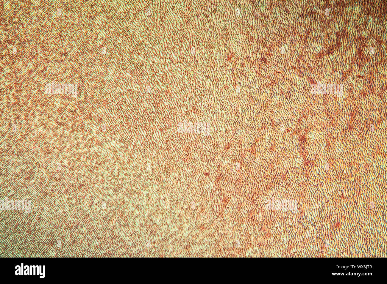 Dental crown cross section 100x Stock Photo - Alamy