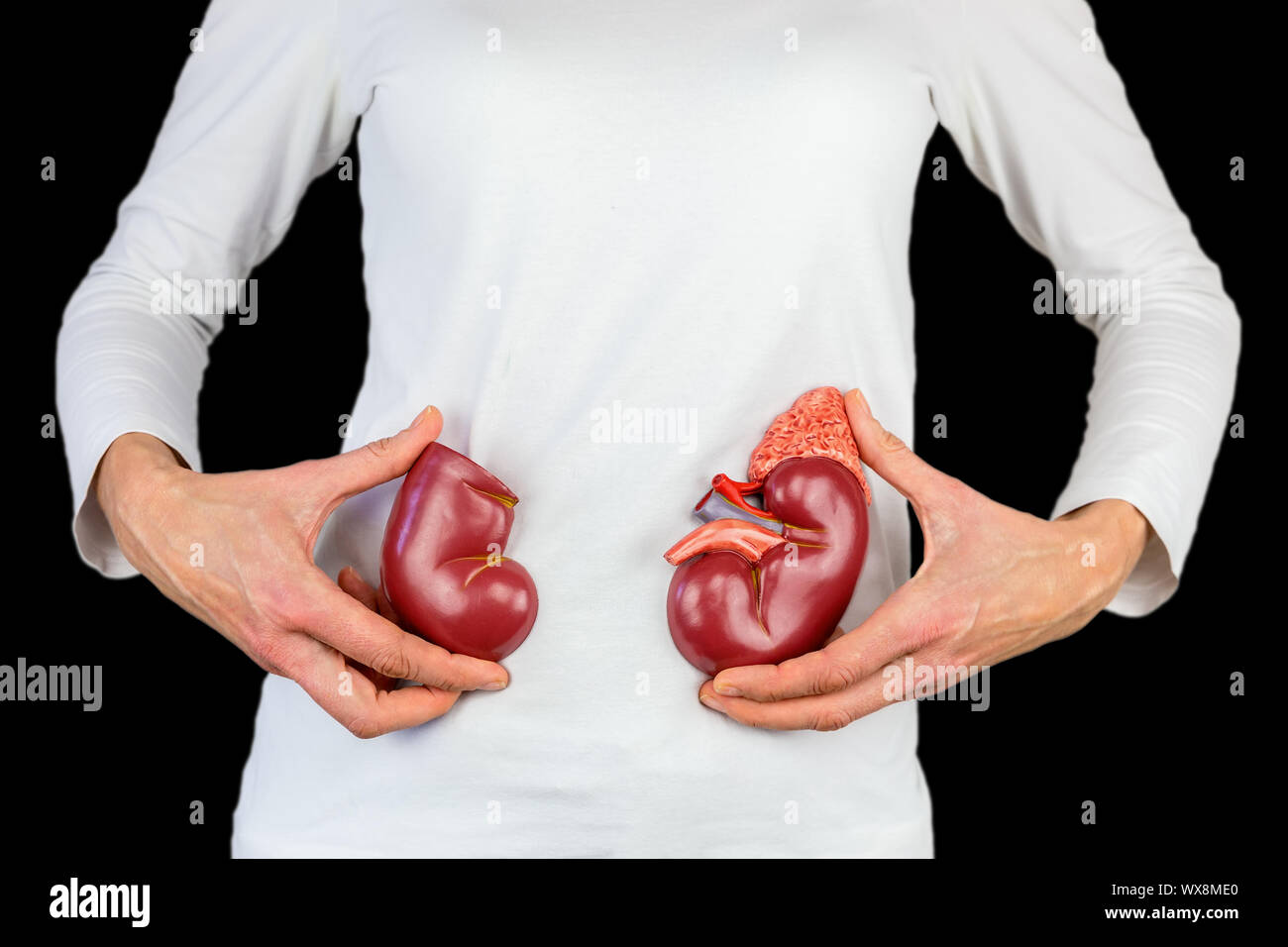 Kidney failure hi-res stock photography and images - Alamy