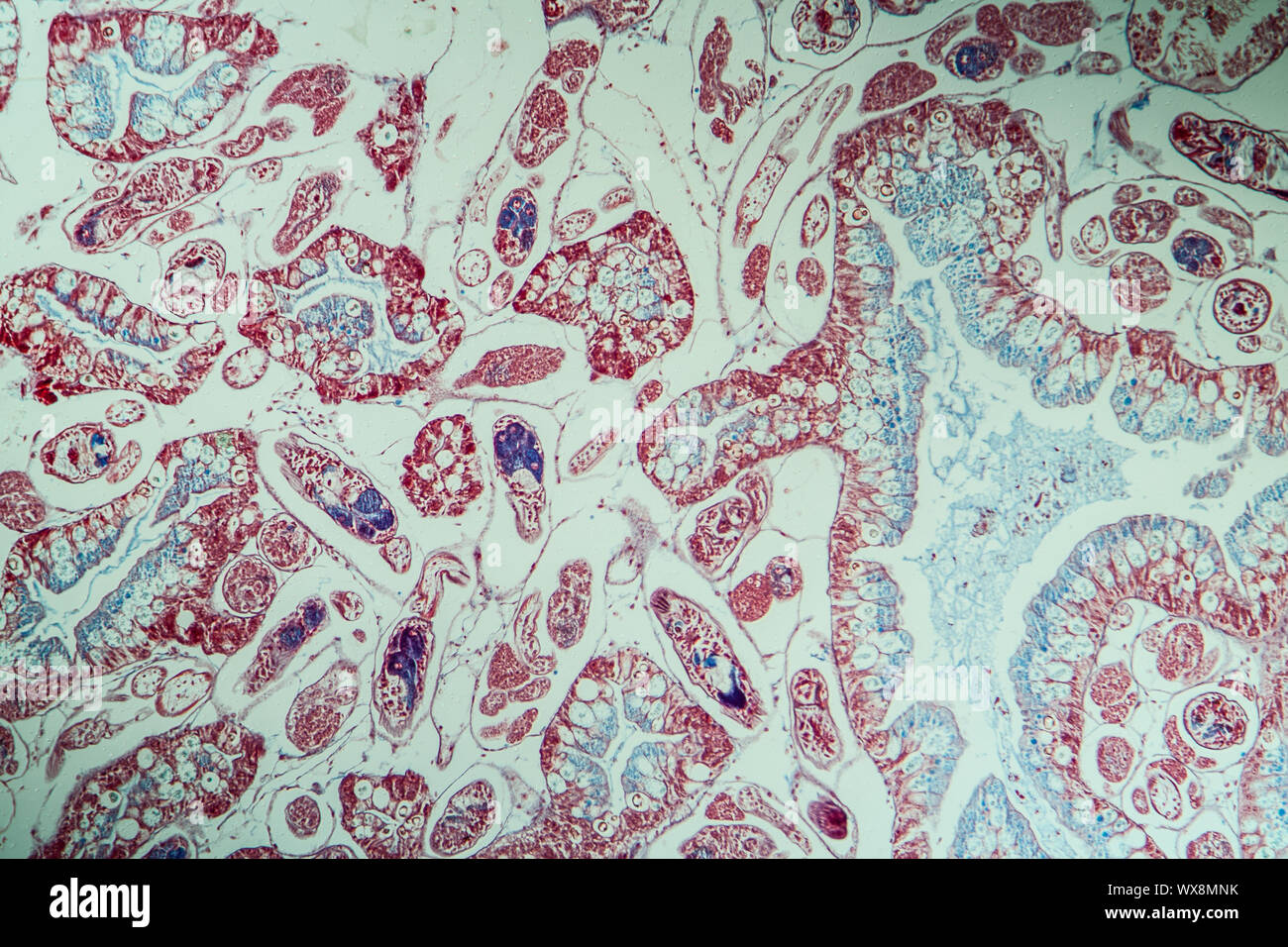 Water snail infection with liver fluke 100x Stock Photo - Alamy