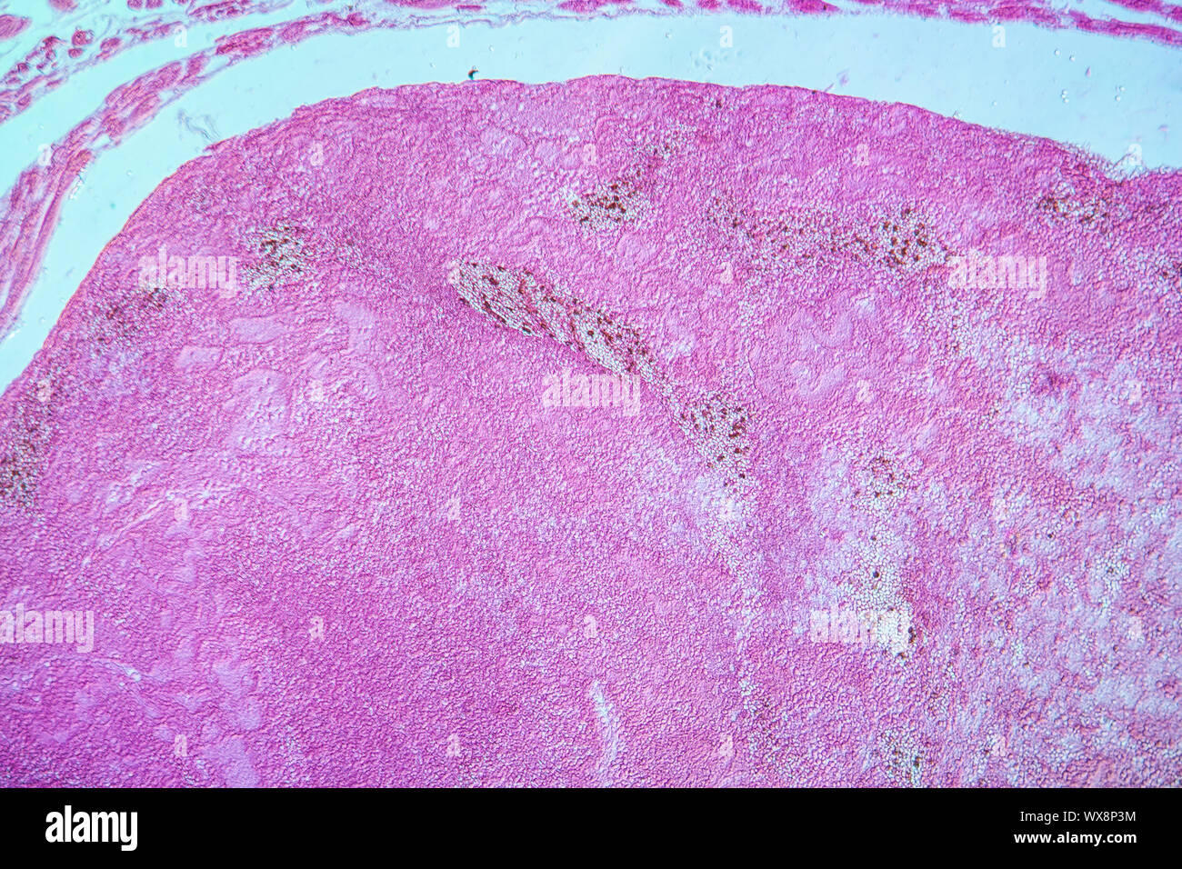 Fat cells hi-res stock photography and images - Alamy