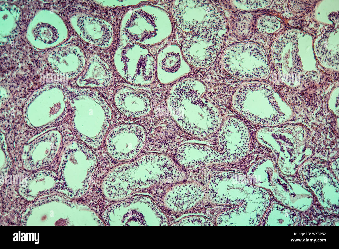 Inguinal testis diseased tissue 100x Stock Photo - Alamy