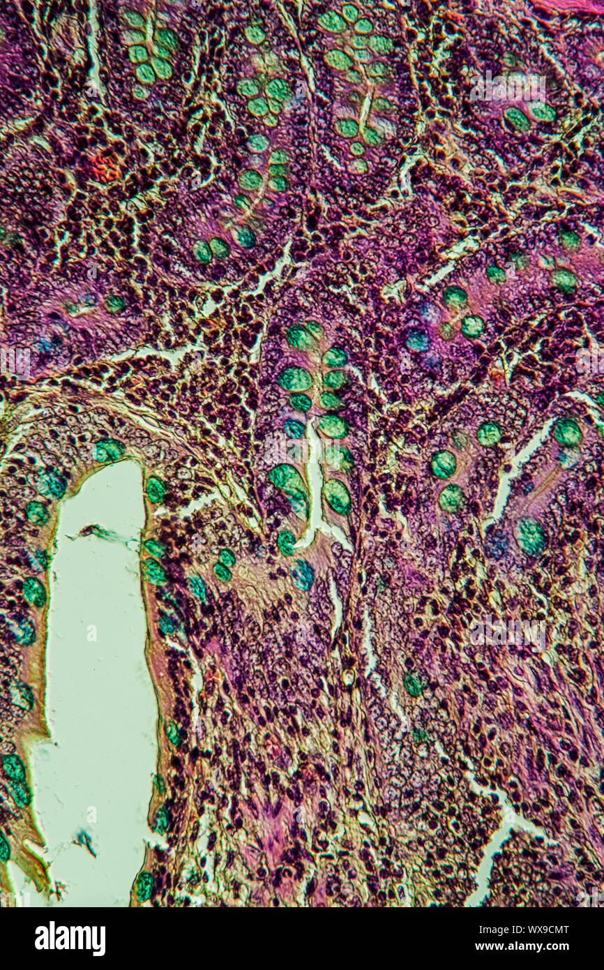 Small intestine hi-res stock photography and images - Alamy