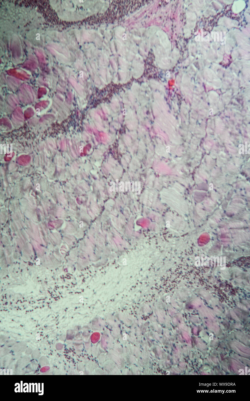 Sarcocystis hi-res stock photography and images - Alamy