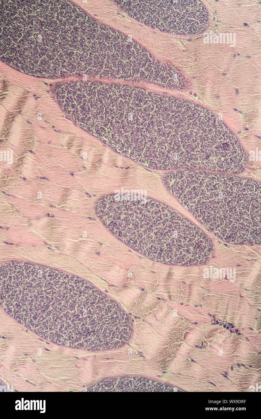 Sarcocystis in monkeys spores in muscle, 200x Stock Photo - Alamy