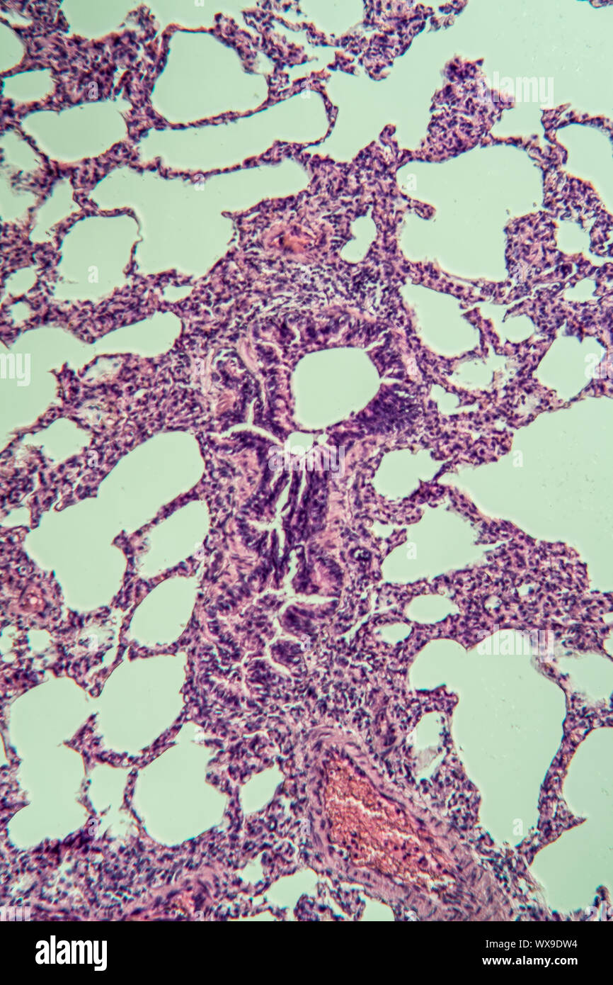 Pig lung under the microscope 100x Stock Photo - Alamy