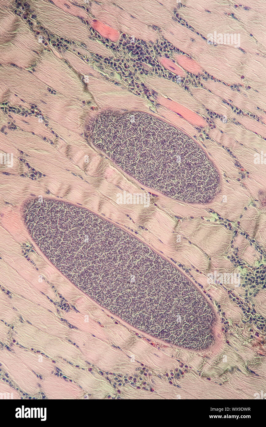 Sarcocystis in monkeys spores in muscle, 200x Stock Photo - Alamy