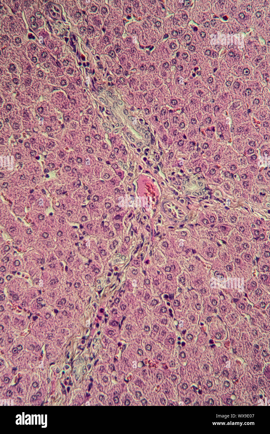 Cross Section Of The Liver High Resolution Stock Photography and Images ...