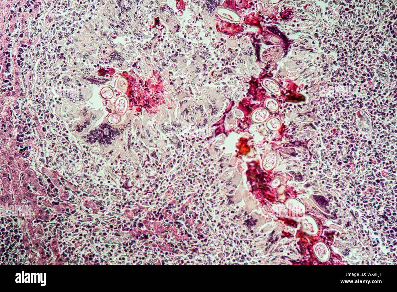 Roebuck parasite eggs in tissue 200x Stock Photo - Alamy