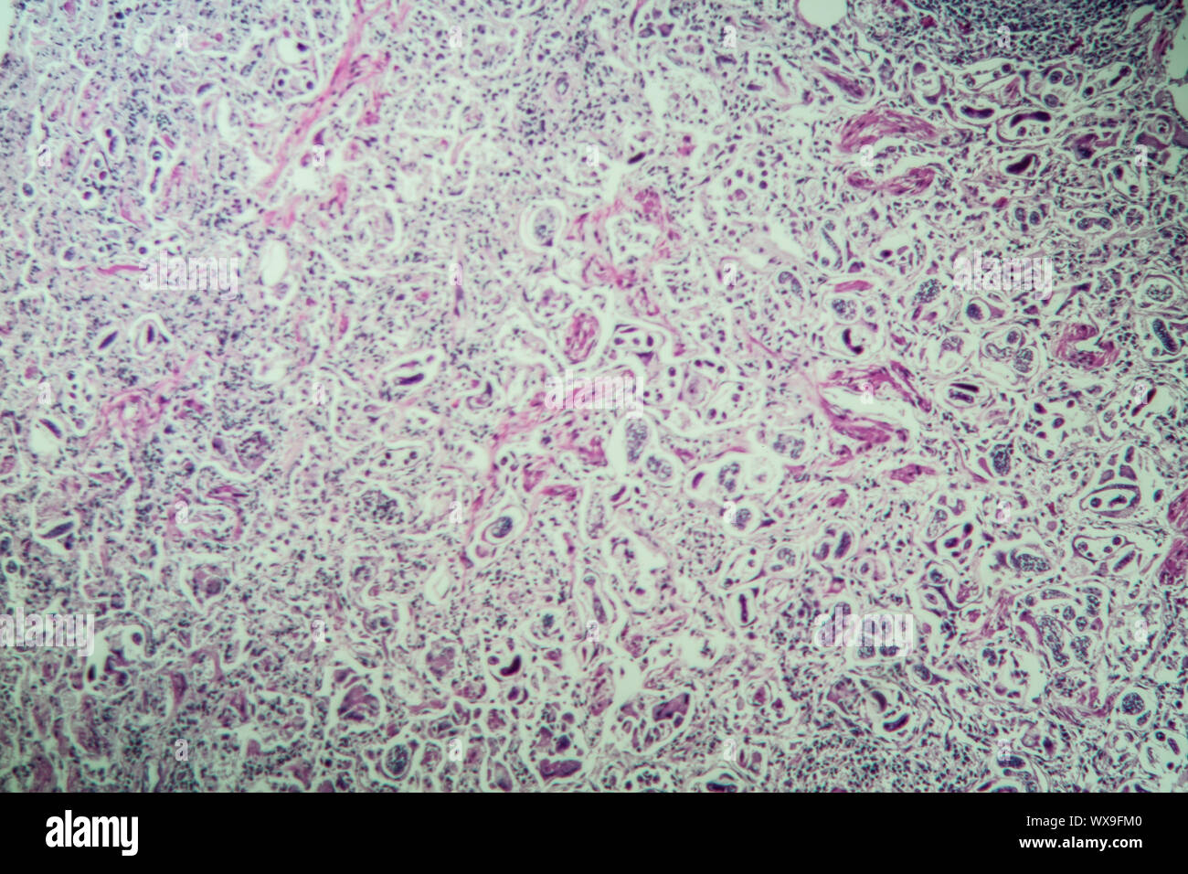 Lungworm hi-res stock photography and images - Alamy