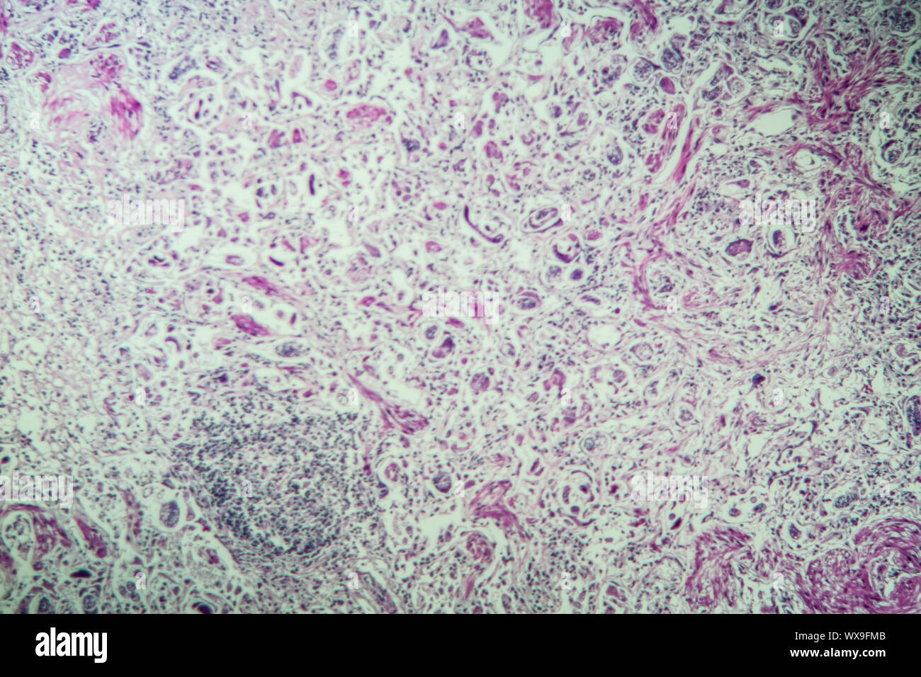Parasites microscope hi-res stock photography and images - Alamy