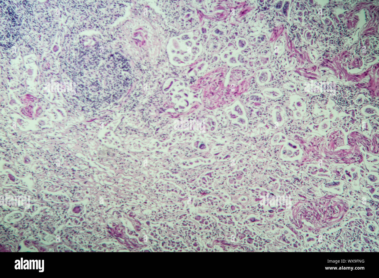 Roebuck lungworm under the microscope 100x Stock Photo - Alamy