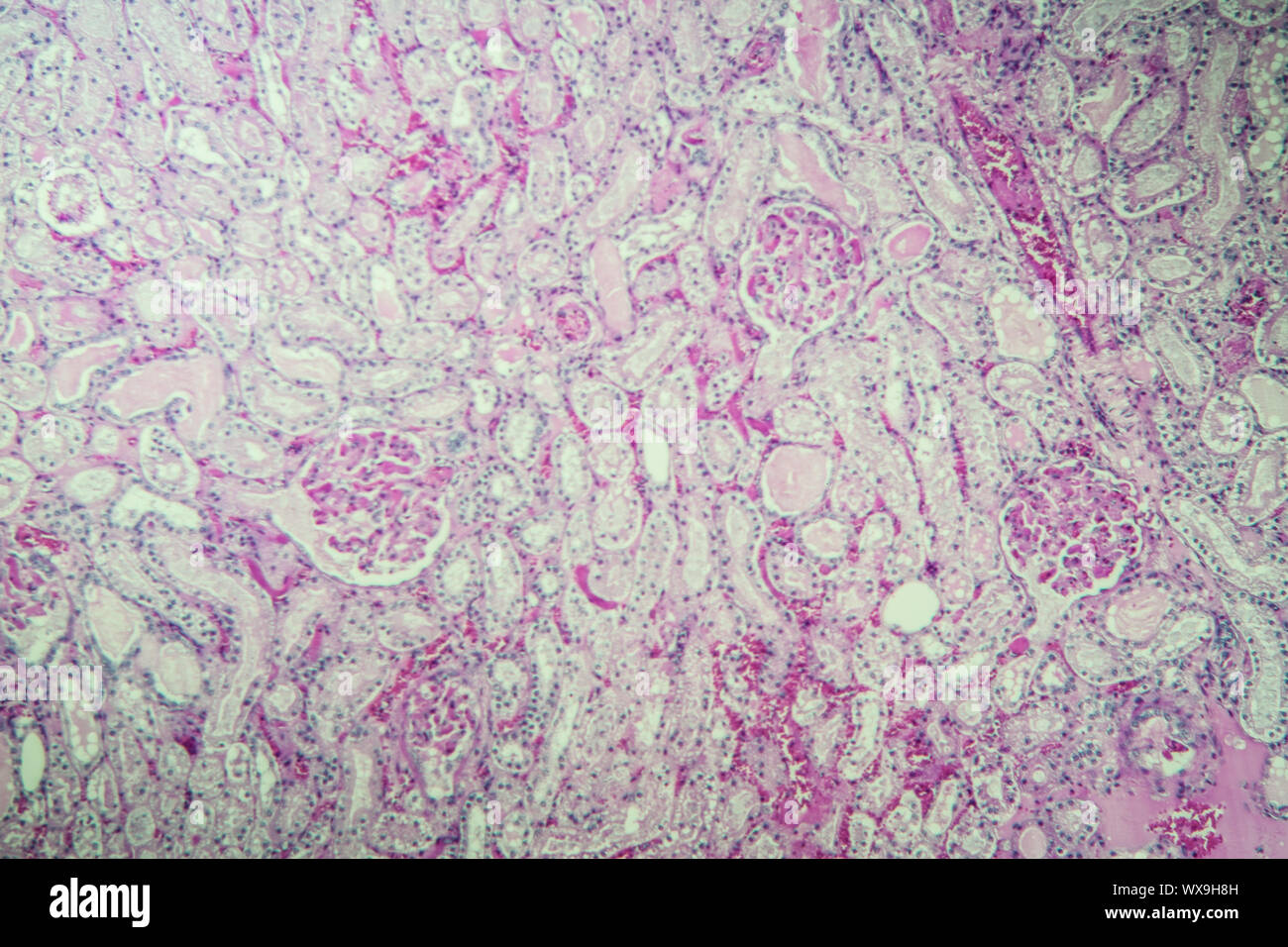 Renal Capsule Histology