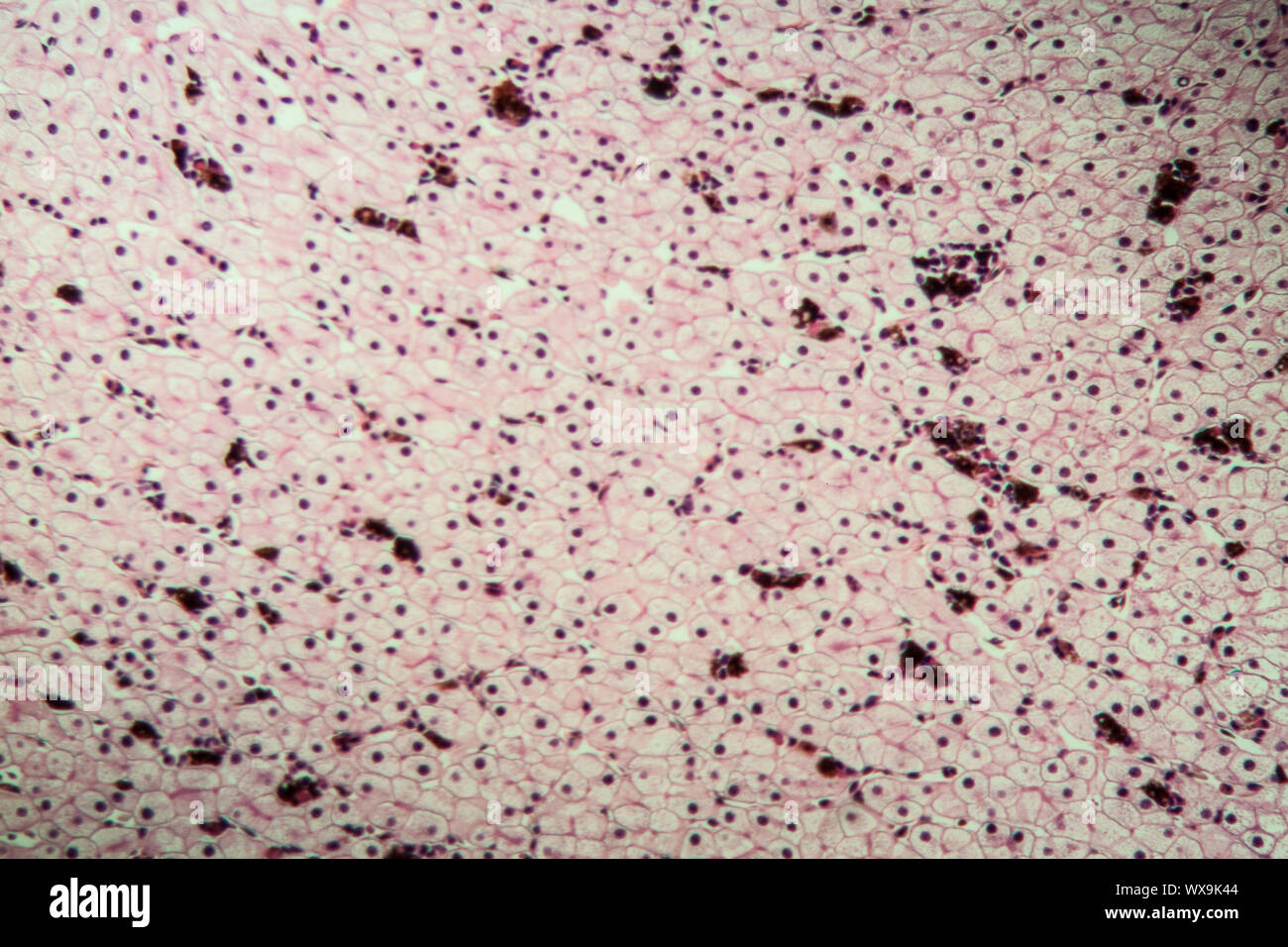 Liver cell hi-res stock photography and images - Alamy