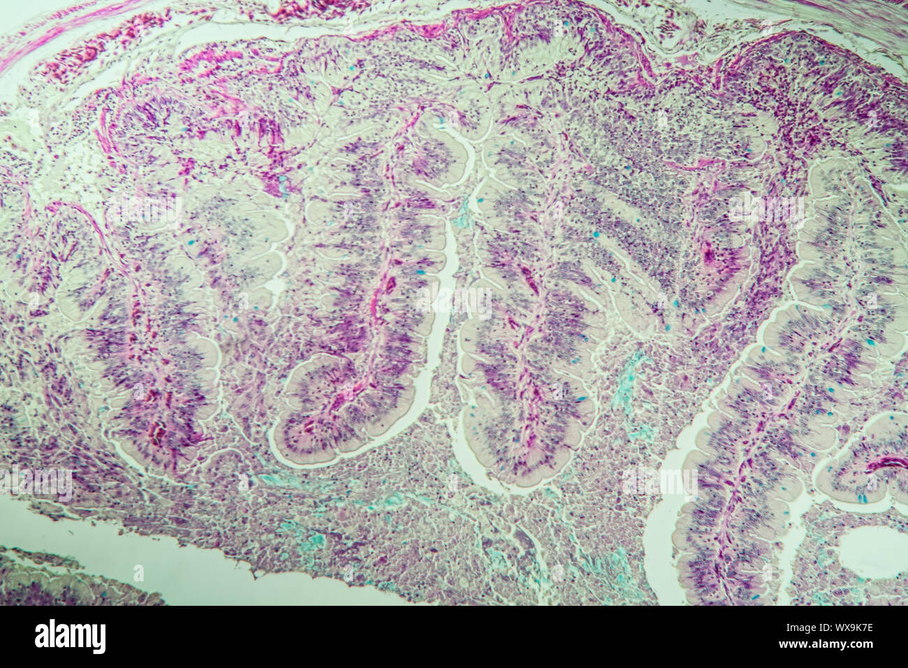 Bowel Examination High Resolution Stock Photography and Images - Alamy