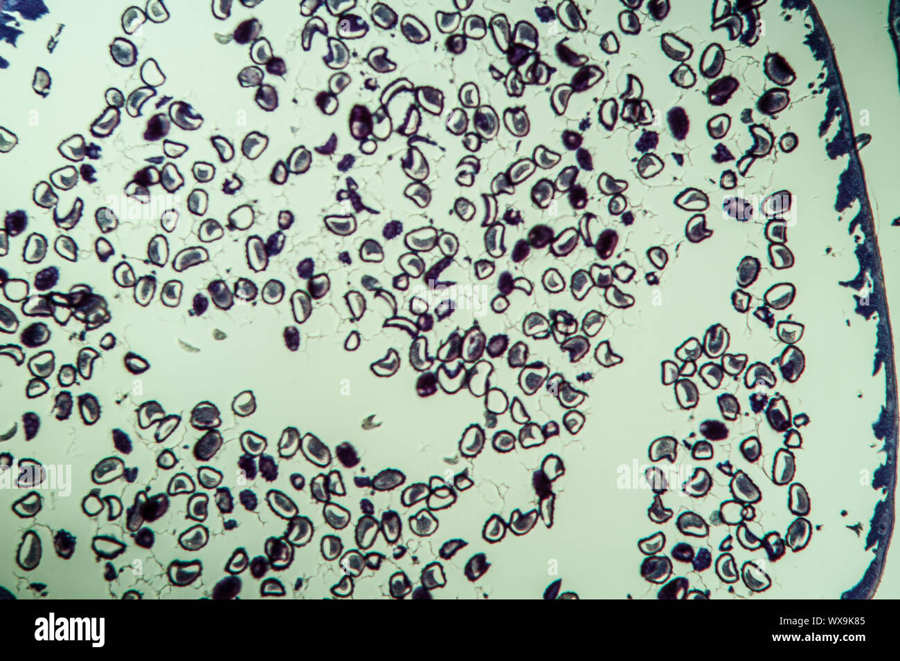 Horse powder worm cross section 100x Stock Photo - Alamy