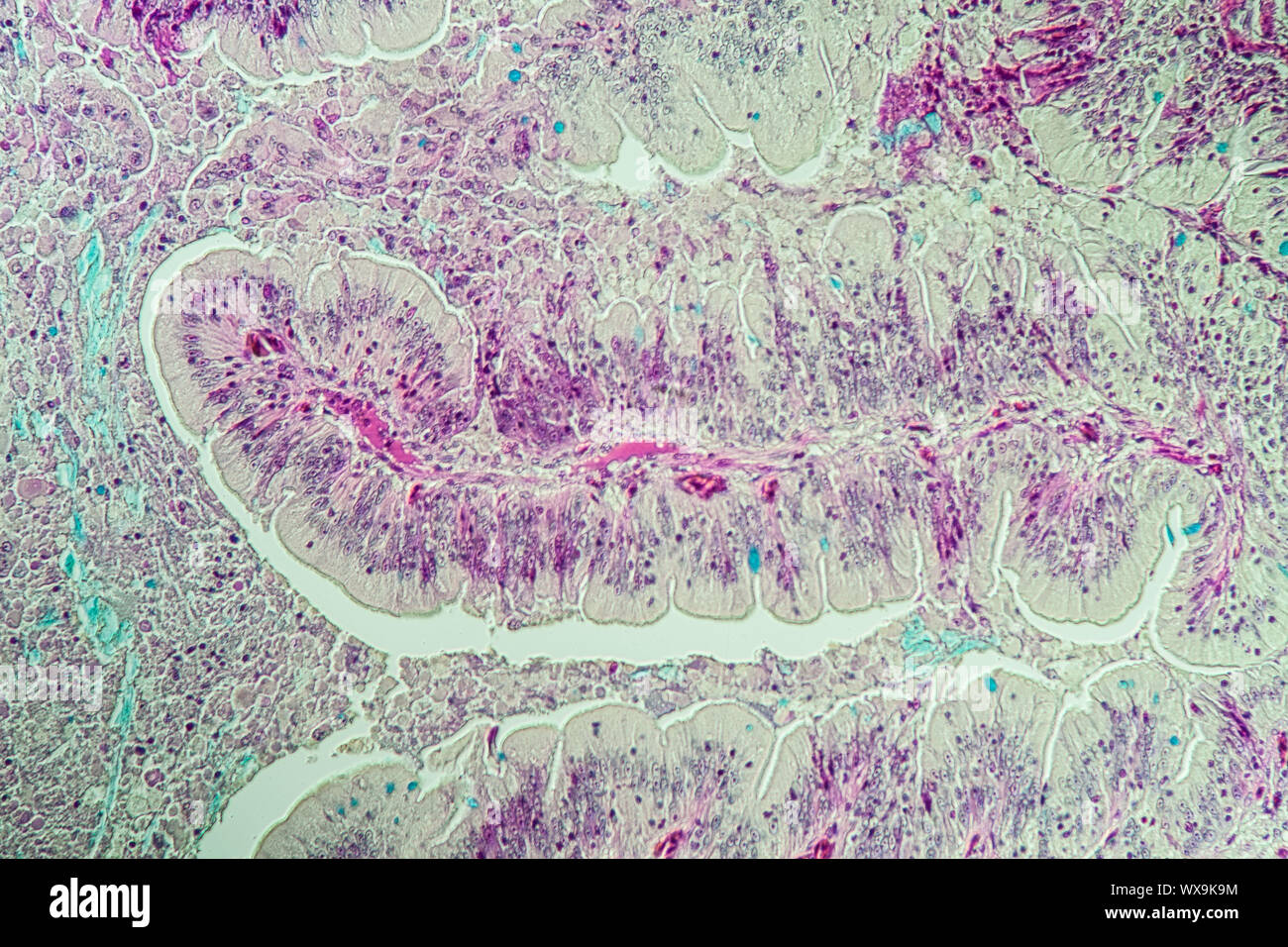 Intestinal glands hi-res stock photography and images - Alamy