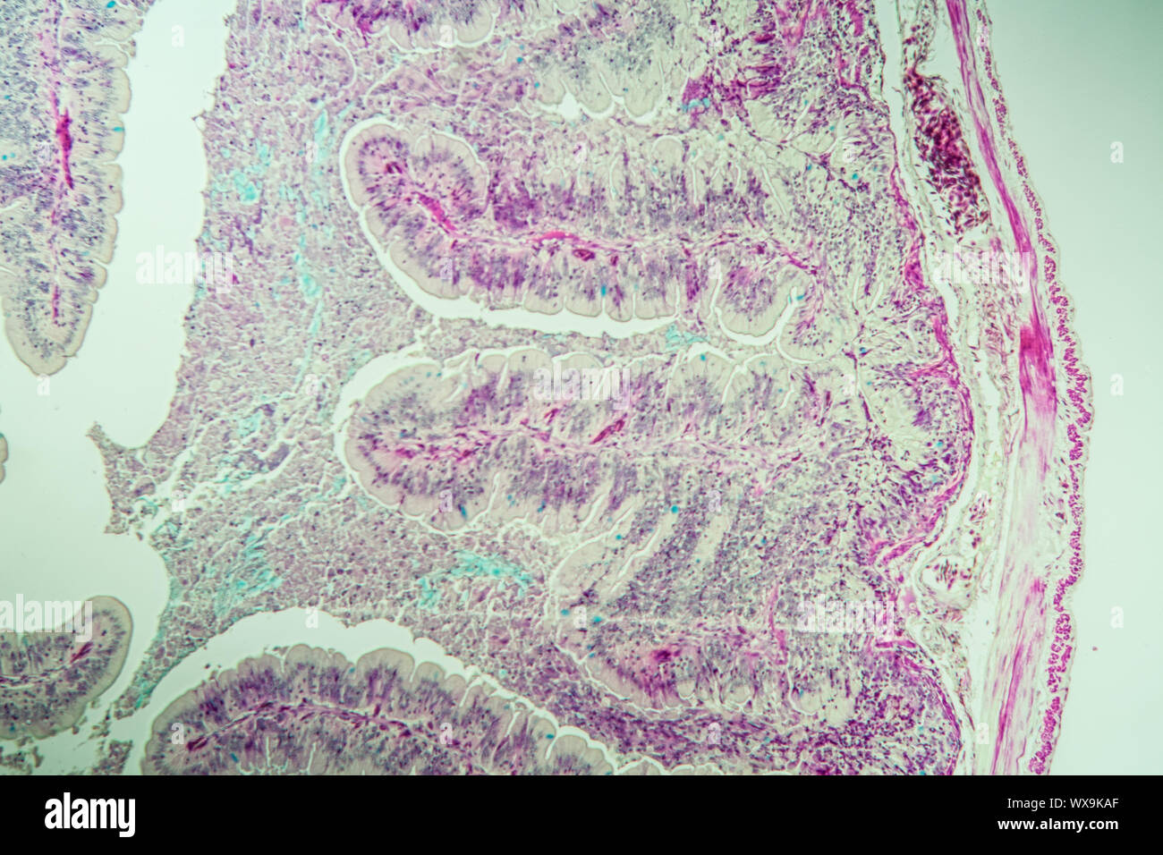 Slow-moving intestinal transverse 200x Stock Photo - Alamy