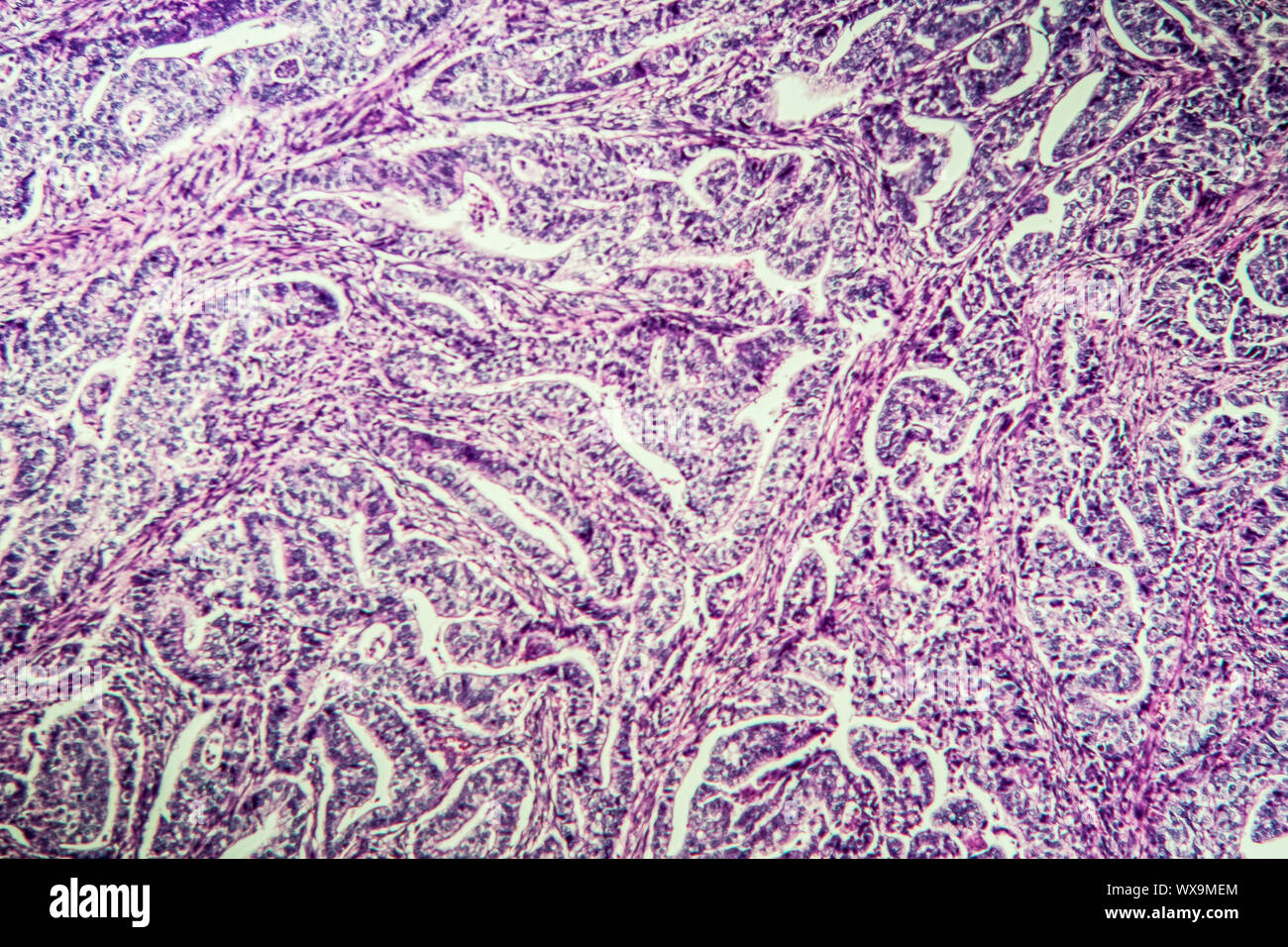 Stomach histology hi-res stock photography and images - Alamy