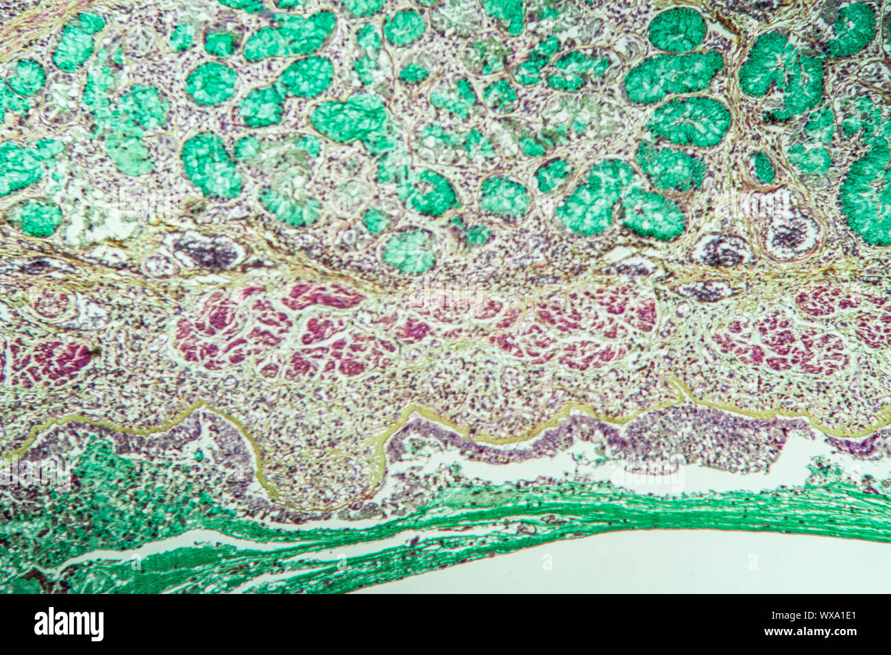 Asthma lung tissue under the microscope 100x Stock Photo - Alamy