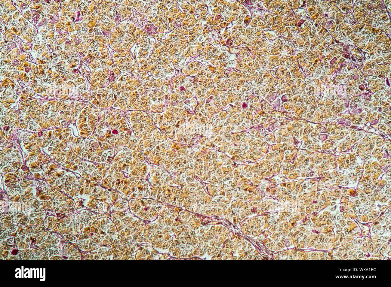 Pituitary gland histology hi-res stock photography and images - Alamy