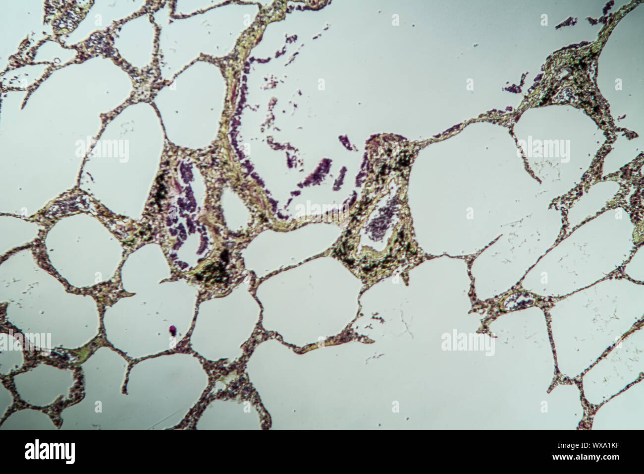 Lung human tissue under the microscope 100x Stock Photo - Alamy