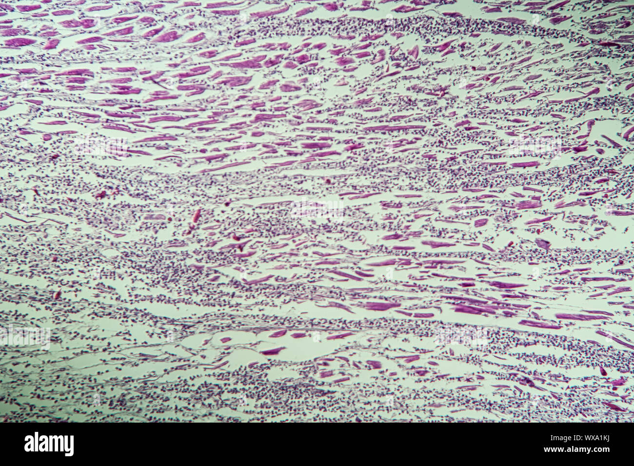Myocardium hi-res stock photography and images - Alamy