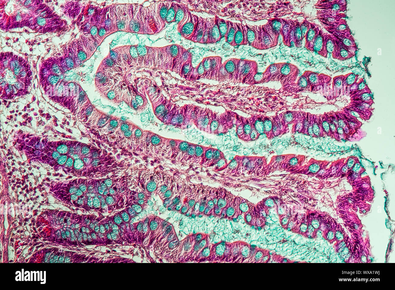 Small intestine with intestinal villi under the microscope 200x Stock ...