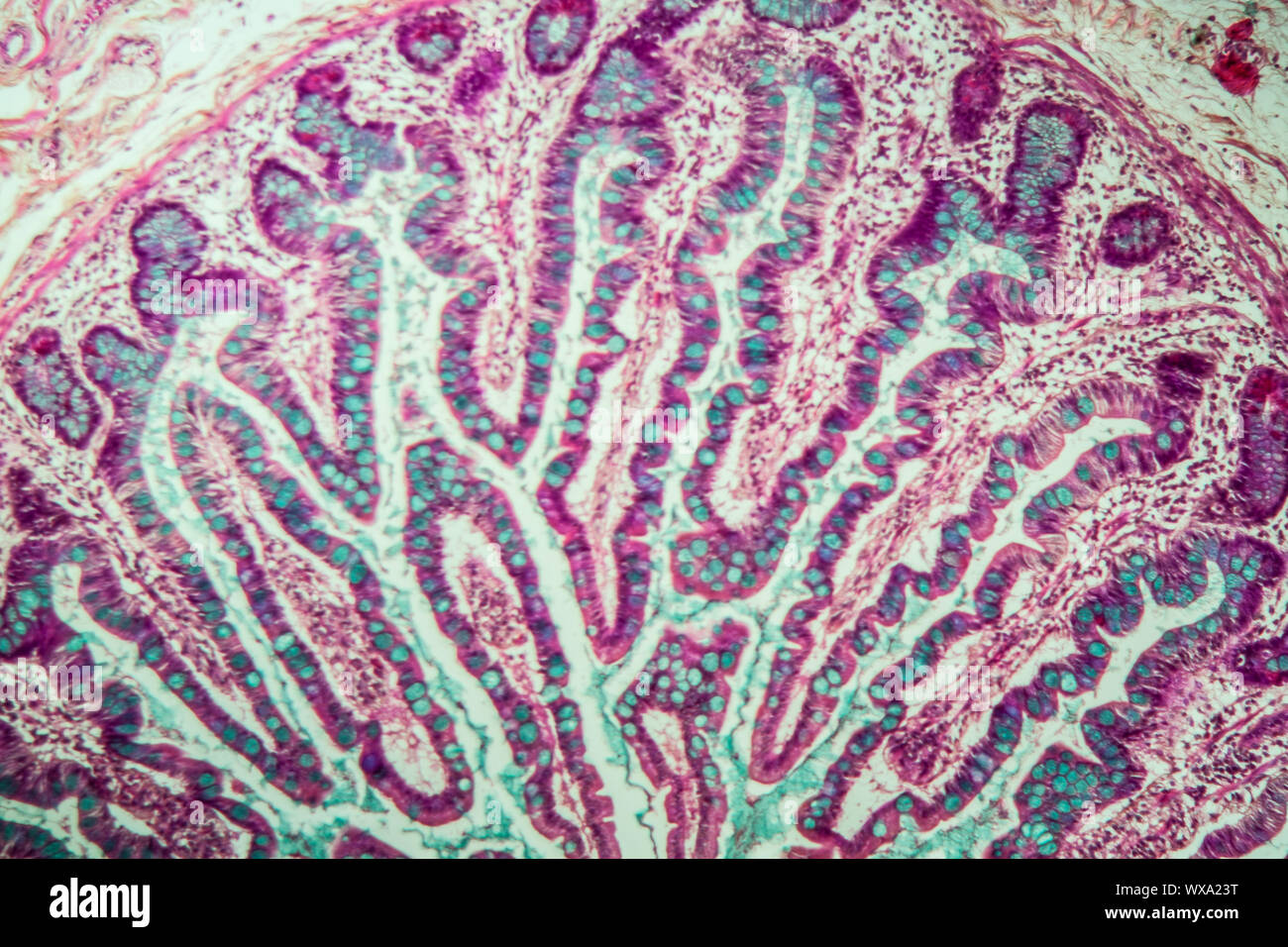 Small intestine with intestinal villi under the microscope 100x Stock ...