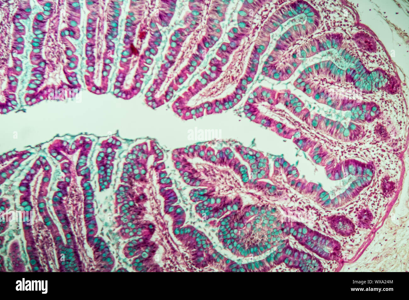 Small Intestine Villi Histology