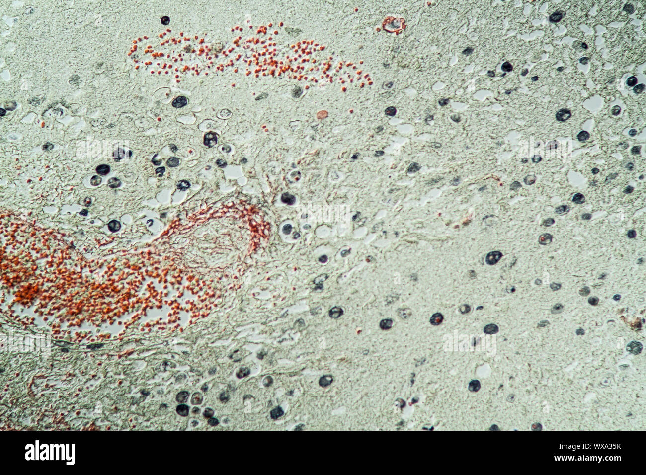 Parasite microscope hi-res stock photography and images - Alamy