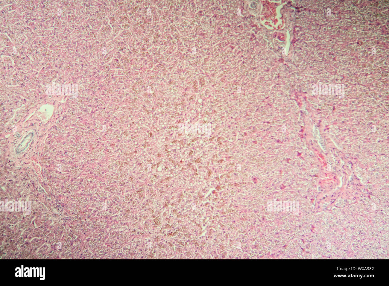 Dubin Johnson liver disease in the microscope 100x Stock Photo - Alamy