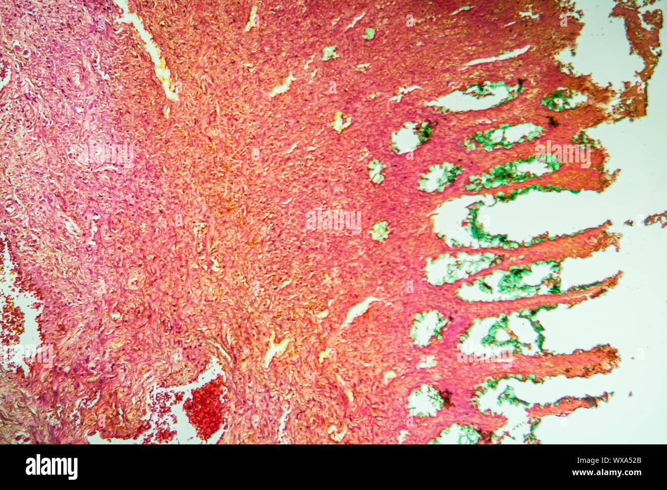 Large intestine histology hi-res stock photography and images - Alamy