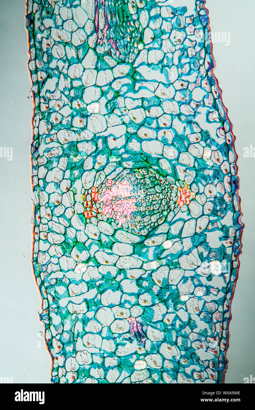 Mistletoe cross section 100x Stock Photo - Alamy