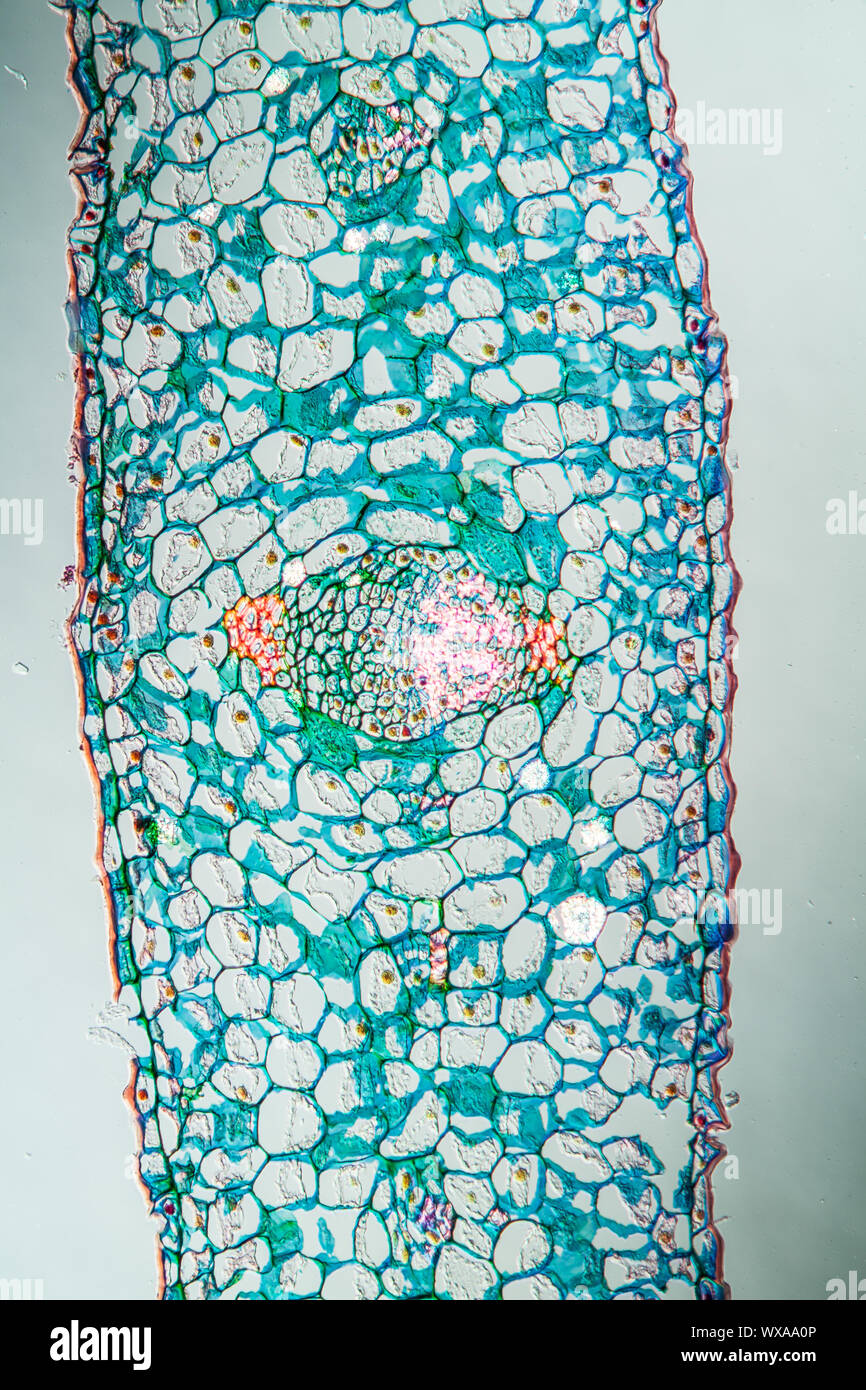 Mistletoe cross section 100x Stock Photo - Alamy