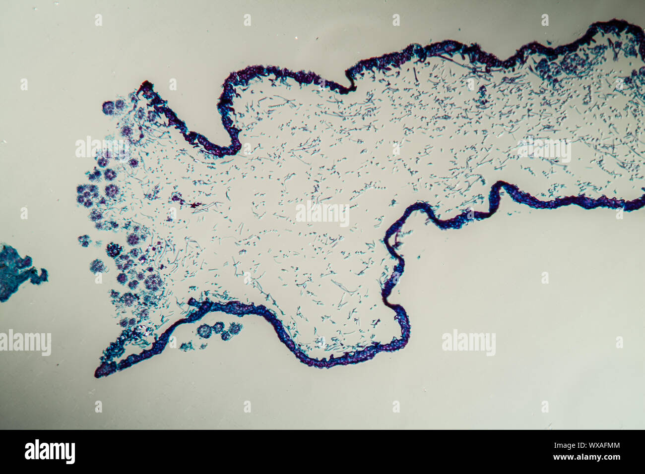 Lichen cross section hi-res stock photography and images - Alamy