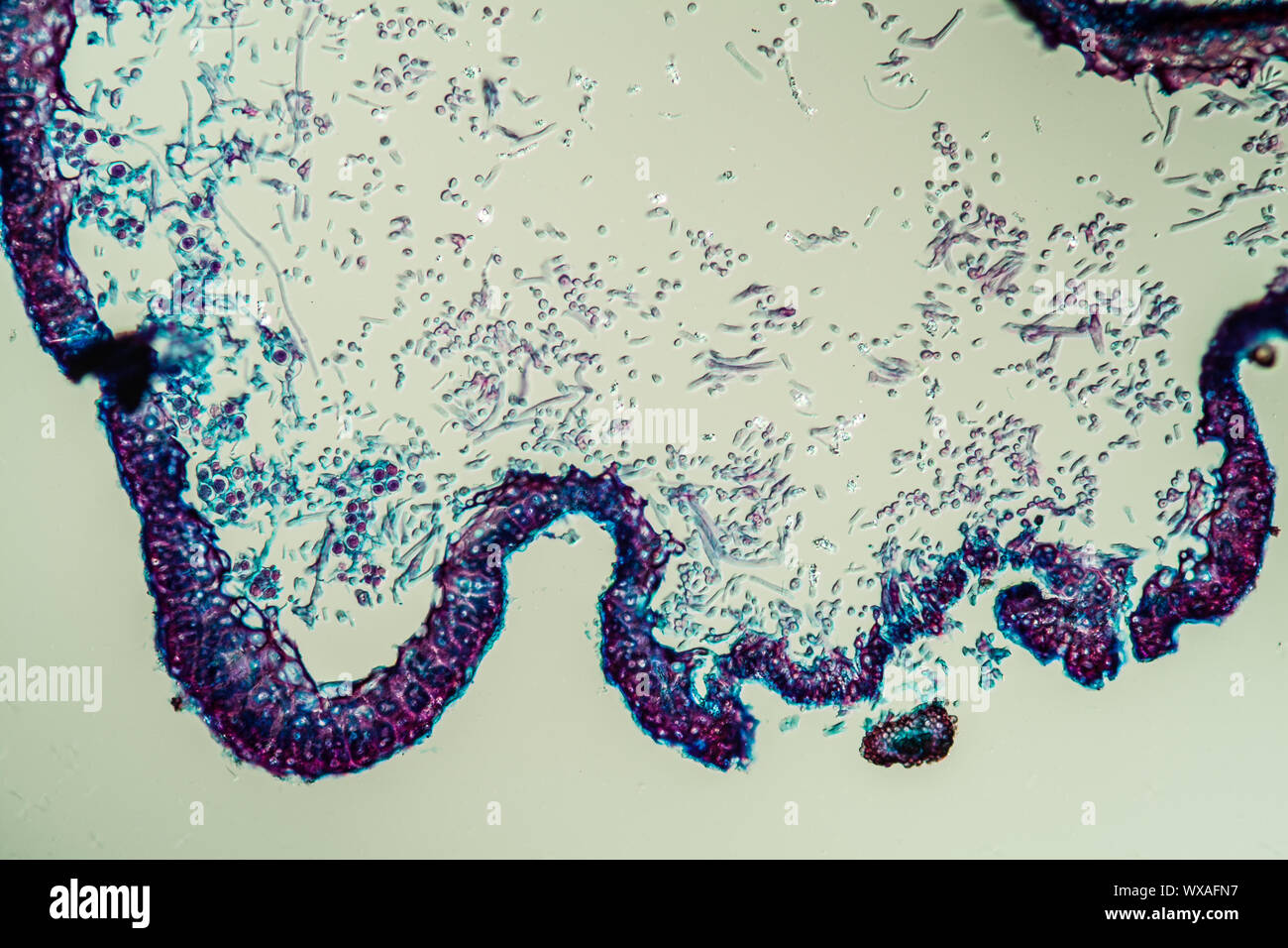 Lichen Cross Section