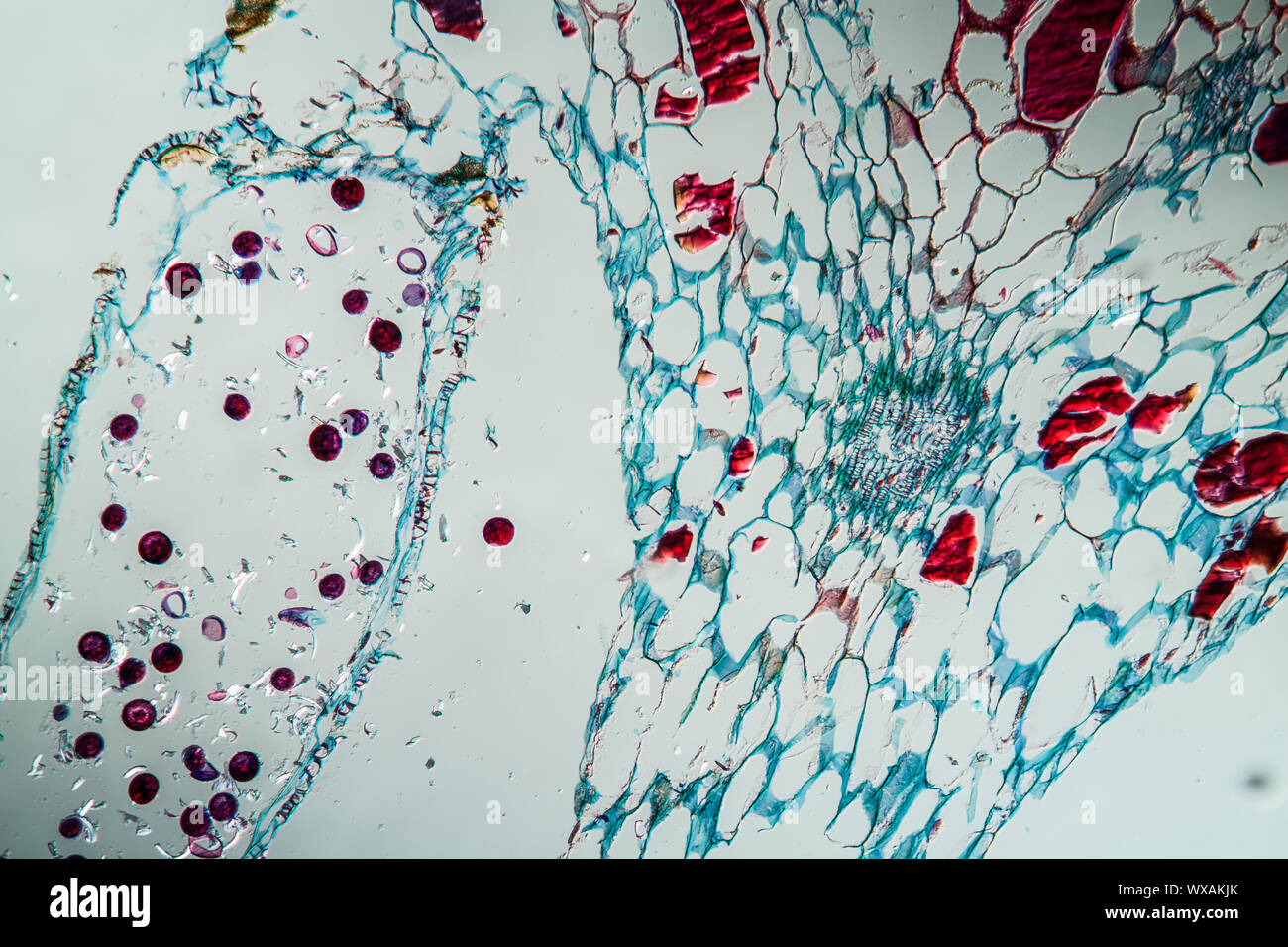 Vascular tissue hi-res stock photography and images - Alamy