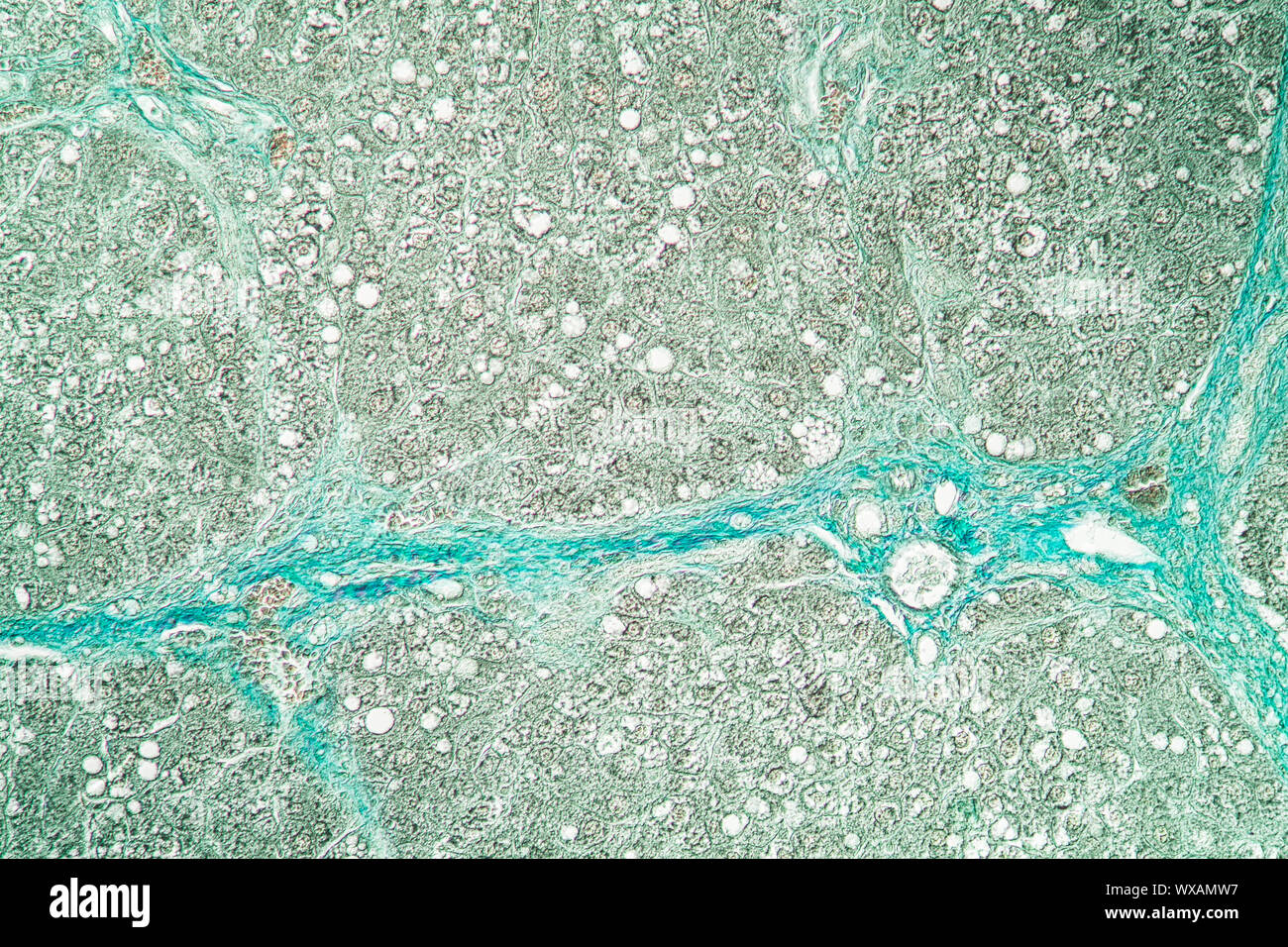 Rat liver tissue section under the microscope 100x Stock Photo - Alamy