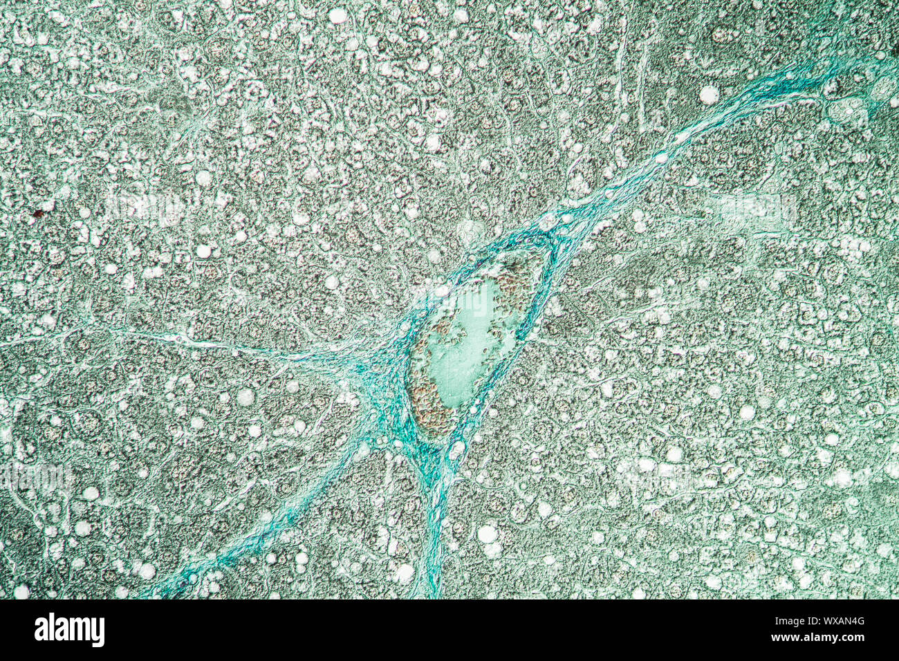 Liver cells microscope hi-res stock photography and images - Alamy
