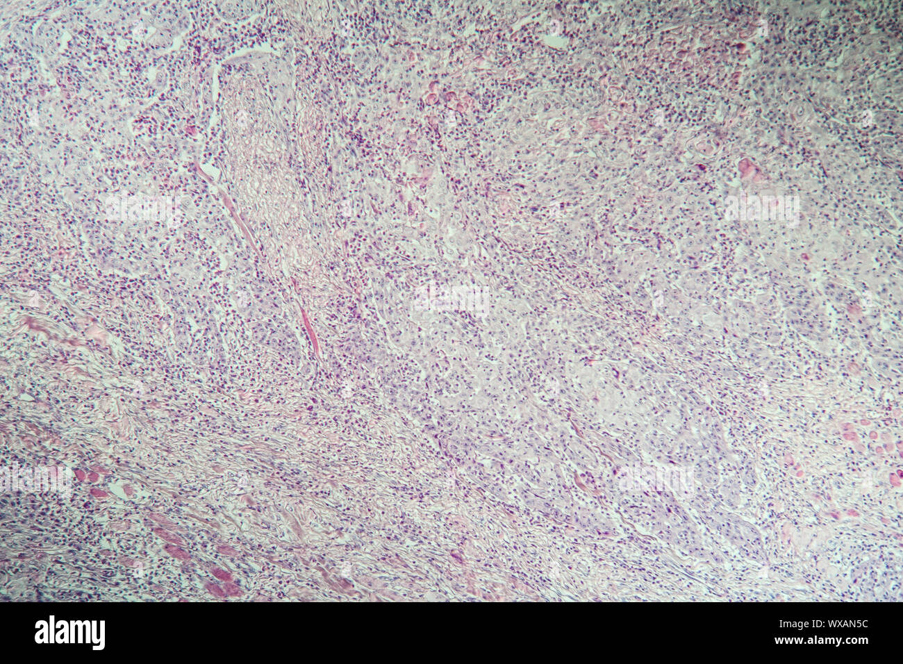 Skin Cells Microscope High Resolution Stock Photography and Images - Alamy