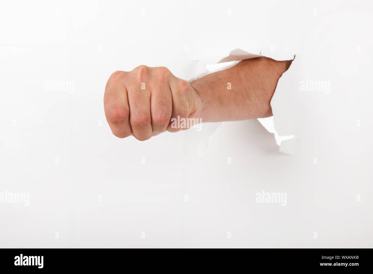 Broken Hand From Punching Wall