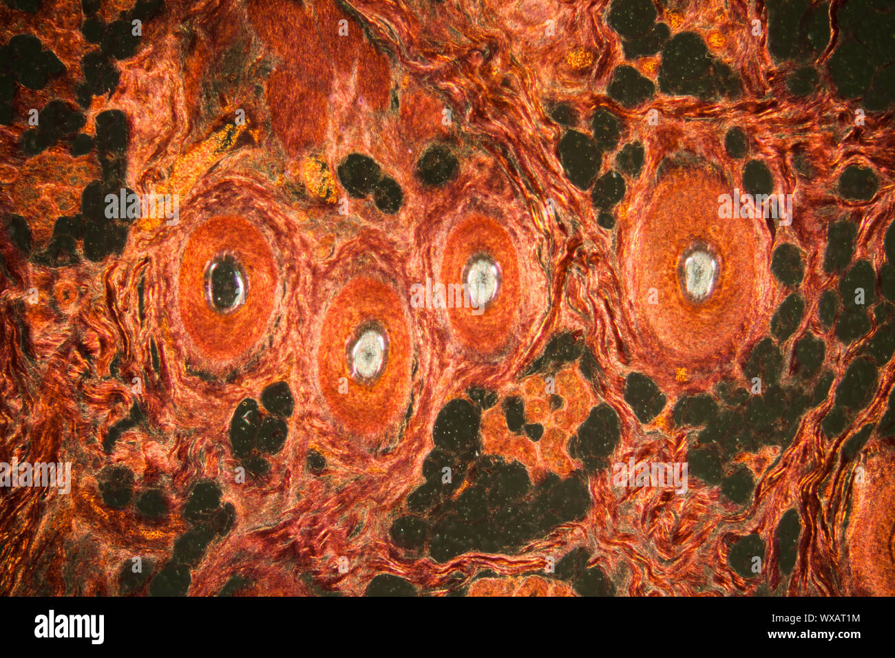 Scalp with hair roots Cross-section under the microscope 100x Stock ...