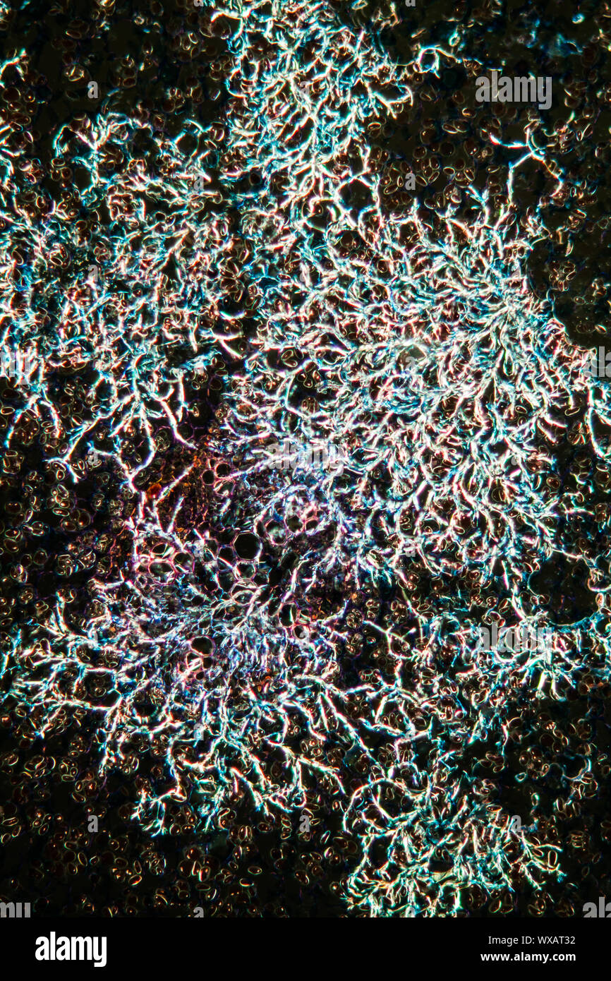 Rhizome of lily of the valley under the microscope 100x Stock Photo - Alamy