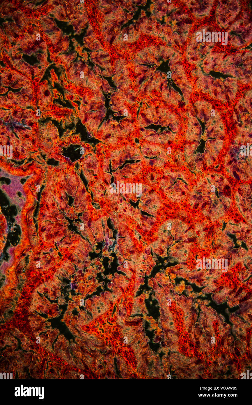 Spider glands cross spider under the microscope 100x Stock Photo - Alamy