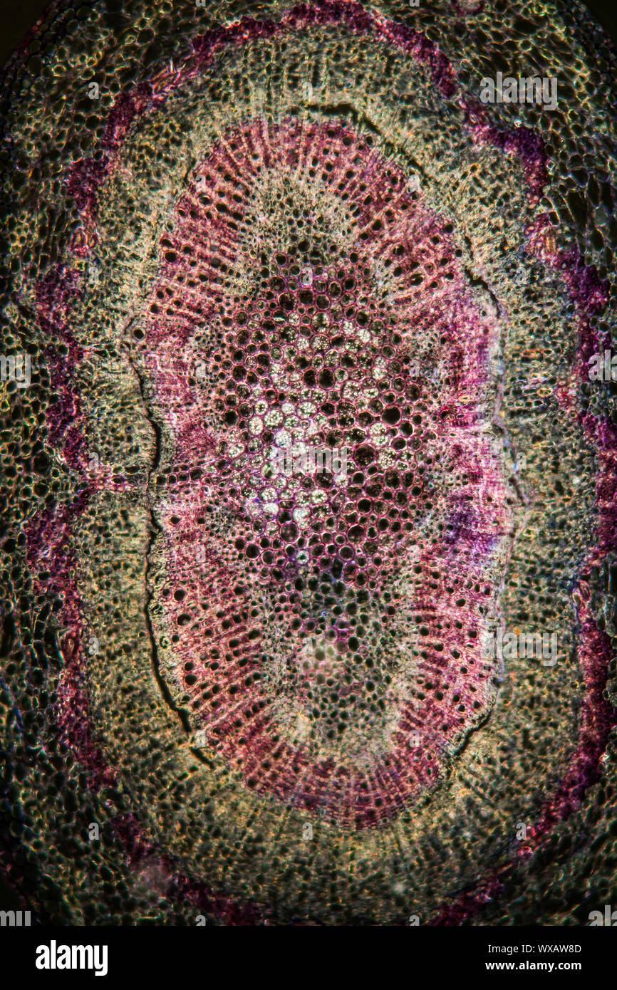 Wood under microscope hi-res stock photography and images - Alamy